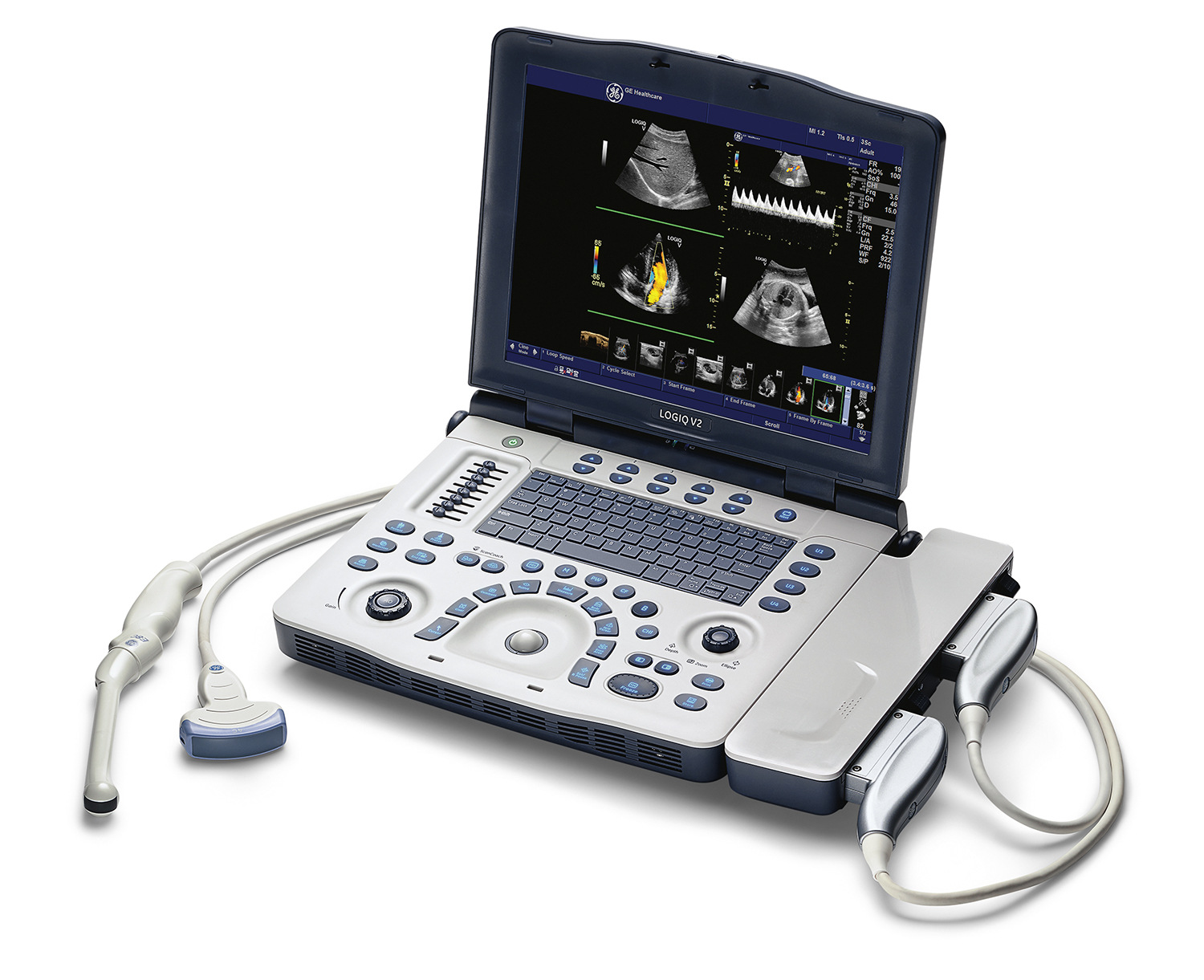 GE Logiq V2 Ultrasound Price Quote and Product Information